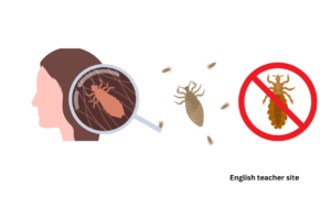 Is Lice Plural or Singular? Understanding the Term's Grammatical Number ...